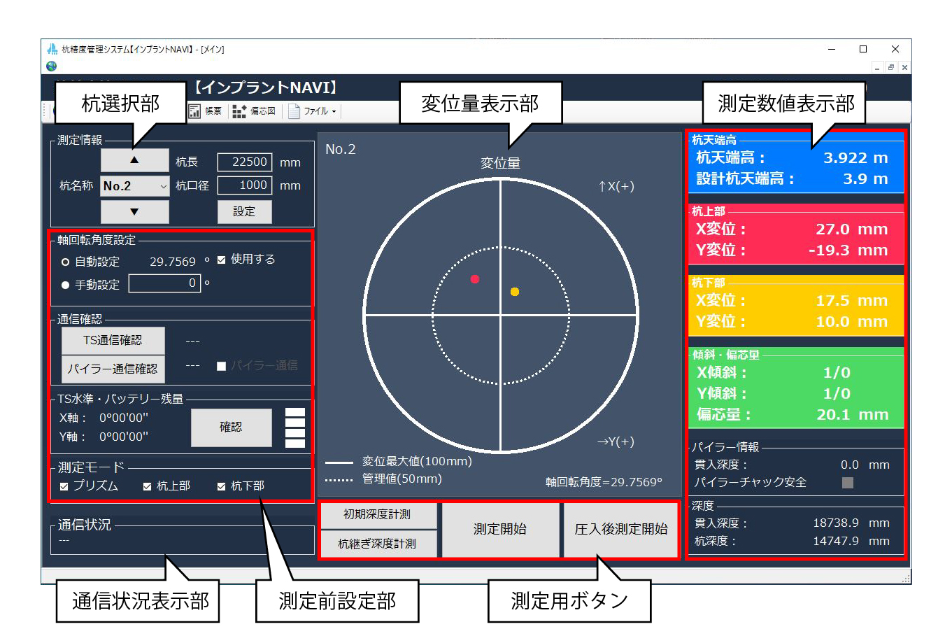 Implant NAVI™ | GIKEN LTD.