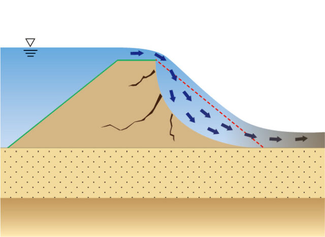 Implant Lock Levee | GIKEN LTD.