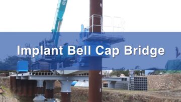 Implant Bell Cap Bridge | GIKEN LTD.