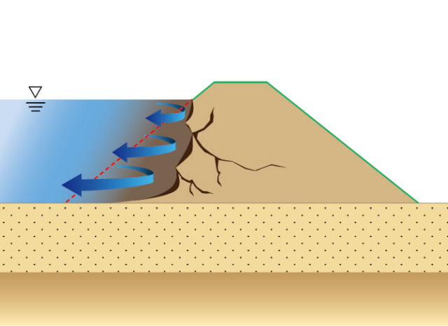 Implant Lock Levee | GIKEN LTD.