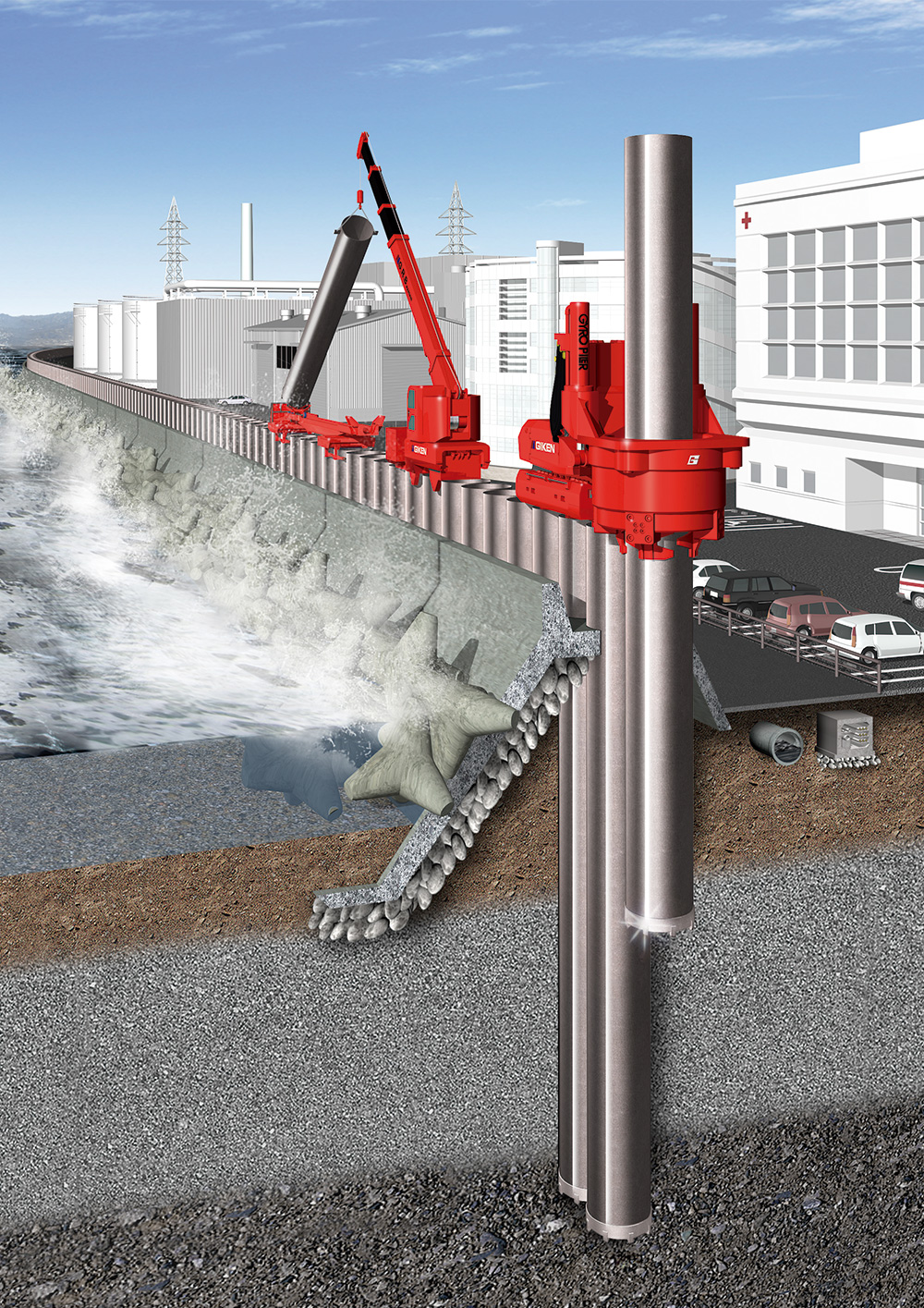 Implant™ Levee | GIKEN LTD.